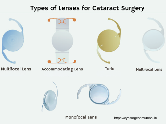 Cataract Surgery best lenses: Multifocal IOLs Lenses