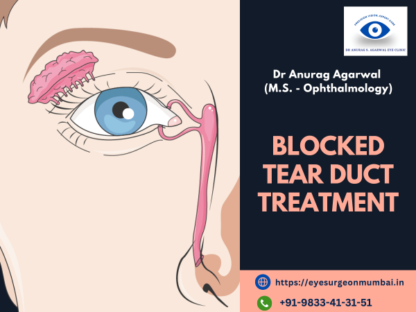 Blocked Tear Duct Treatment in Mumbai - Expert Eye Surgeons